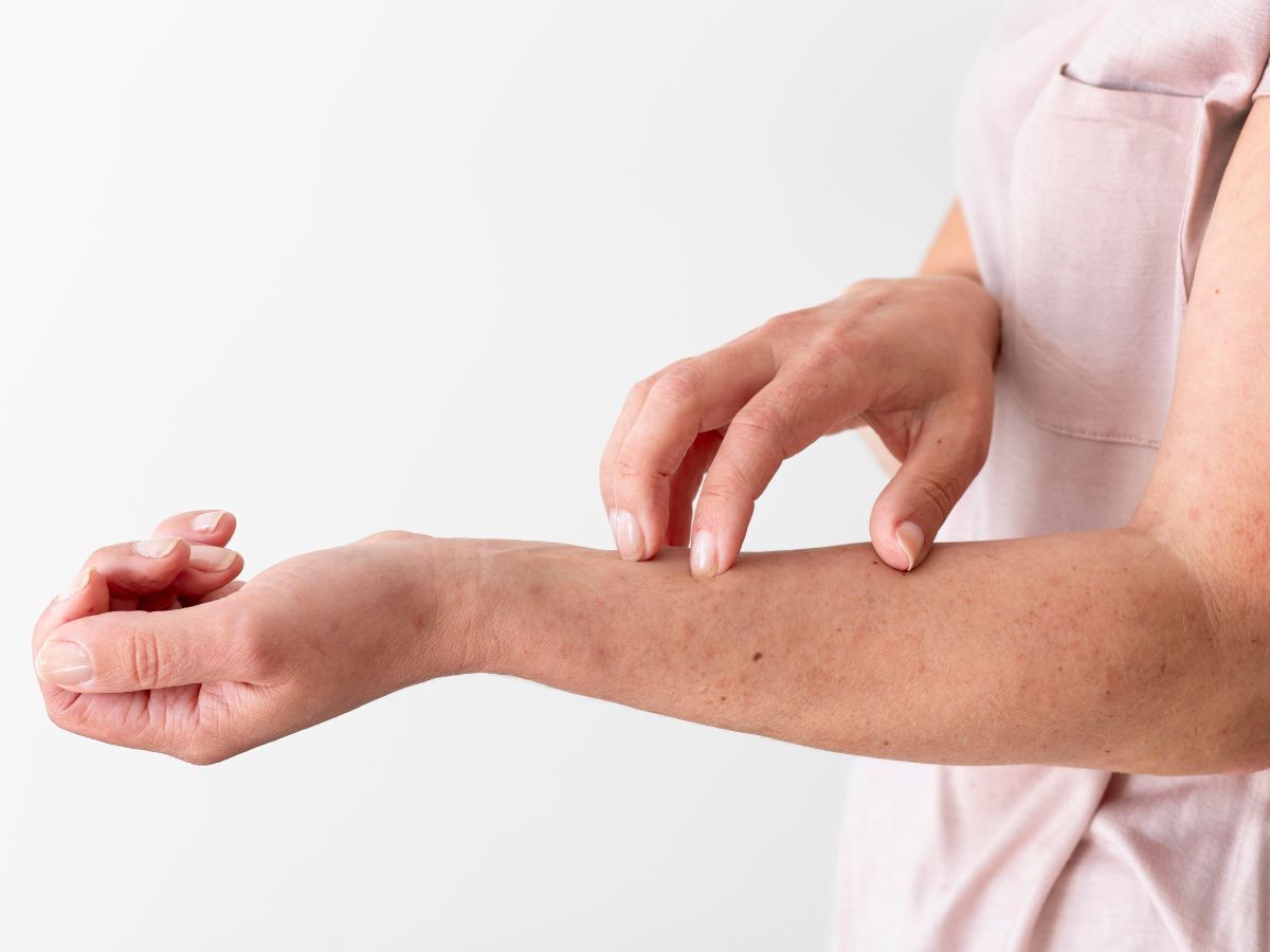 Morsi e punture: rimedi, prevenzione e auando allarmarsi